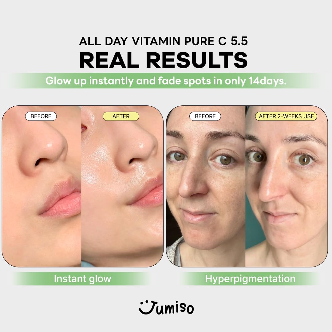 All Day Vitamin Pure C 5.5 Glow Serum – Jumiso USA