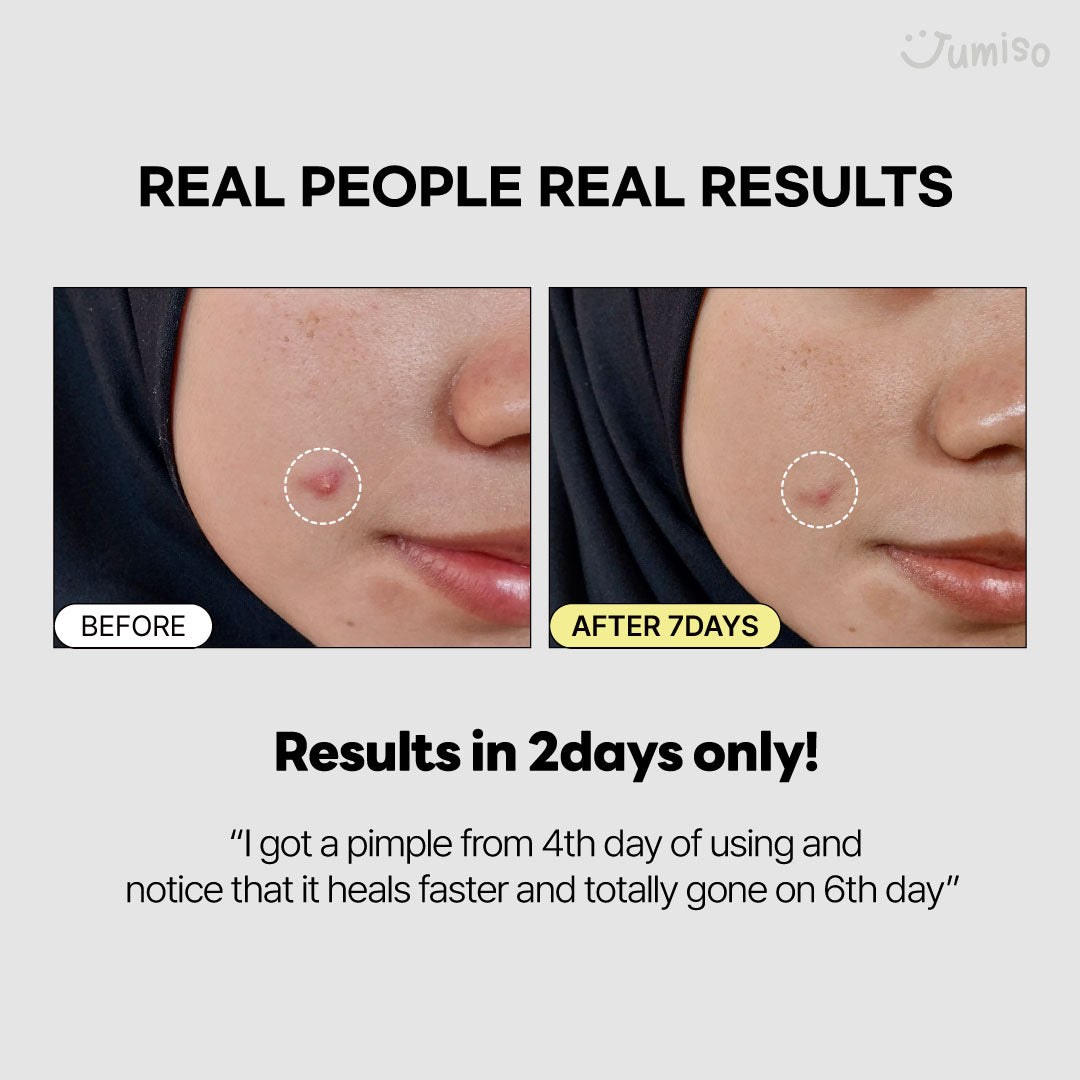 Snail Mucin 95% + Peptide Essence 140ml – Jumiso USA